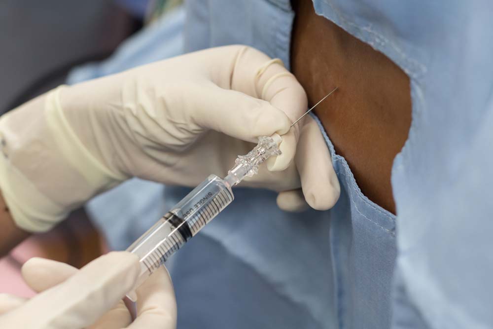 Epidural Steroid - Omega Rehabilitation and Spine